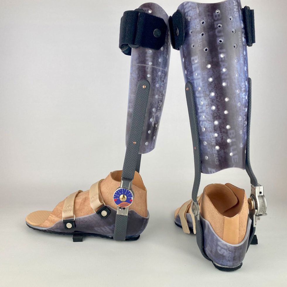 Spitzfuß-Versorgung | Gutgesell Cuxhaven | Sanitätshaus Reha-Technik ...